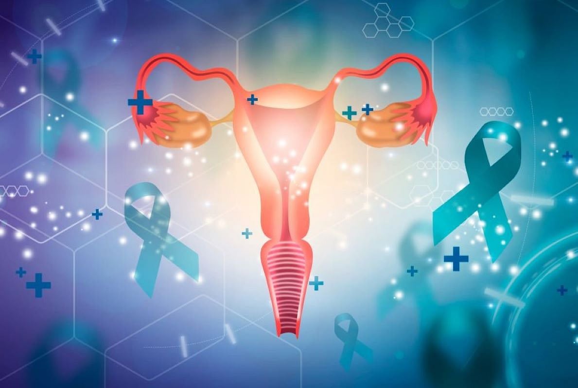 IOTA ADNEX at 10 Percent Has Higher Sensitivity for Ovarian Cancer